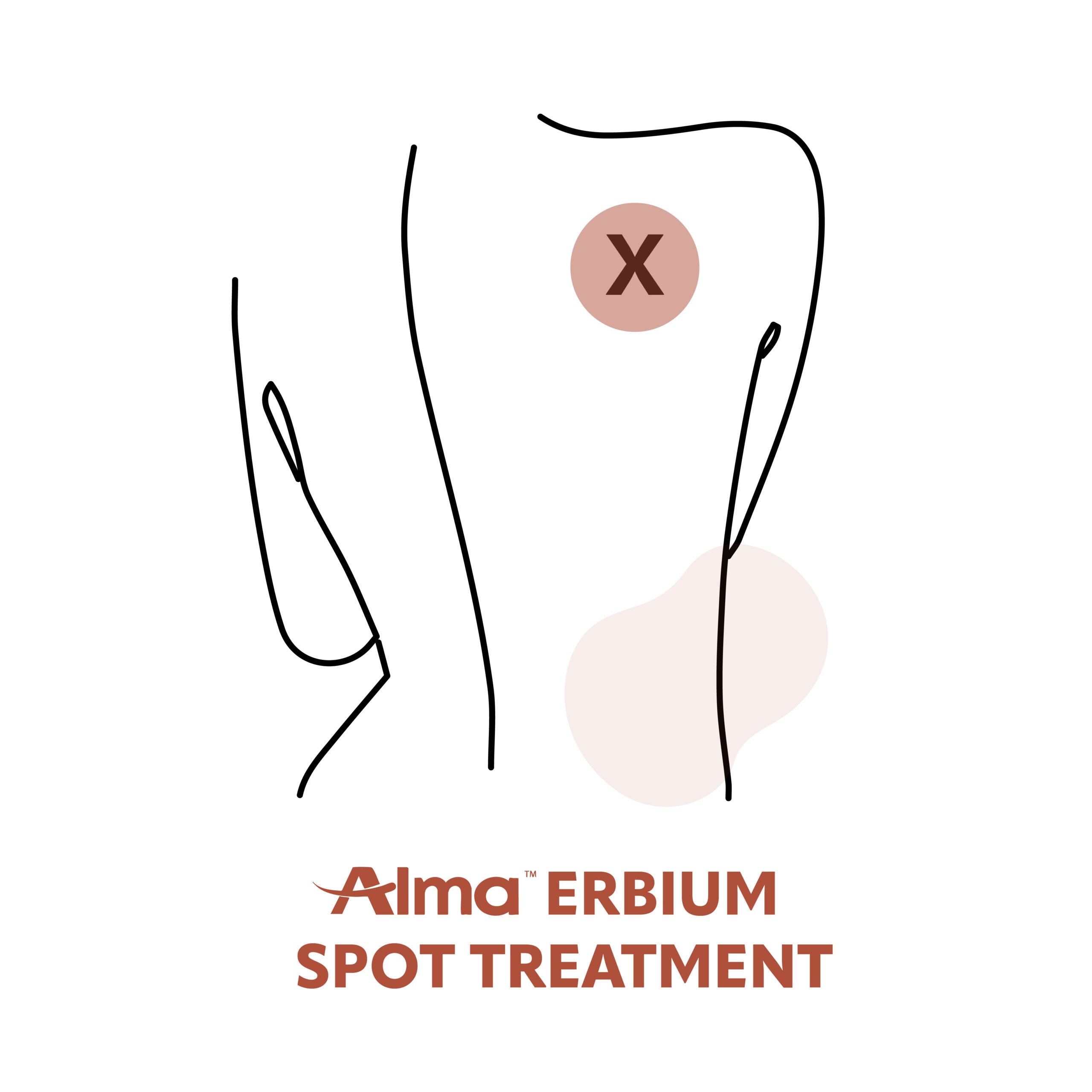 Erbium Spot Treatment – Secret Skin