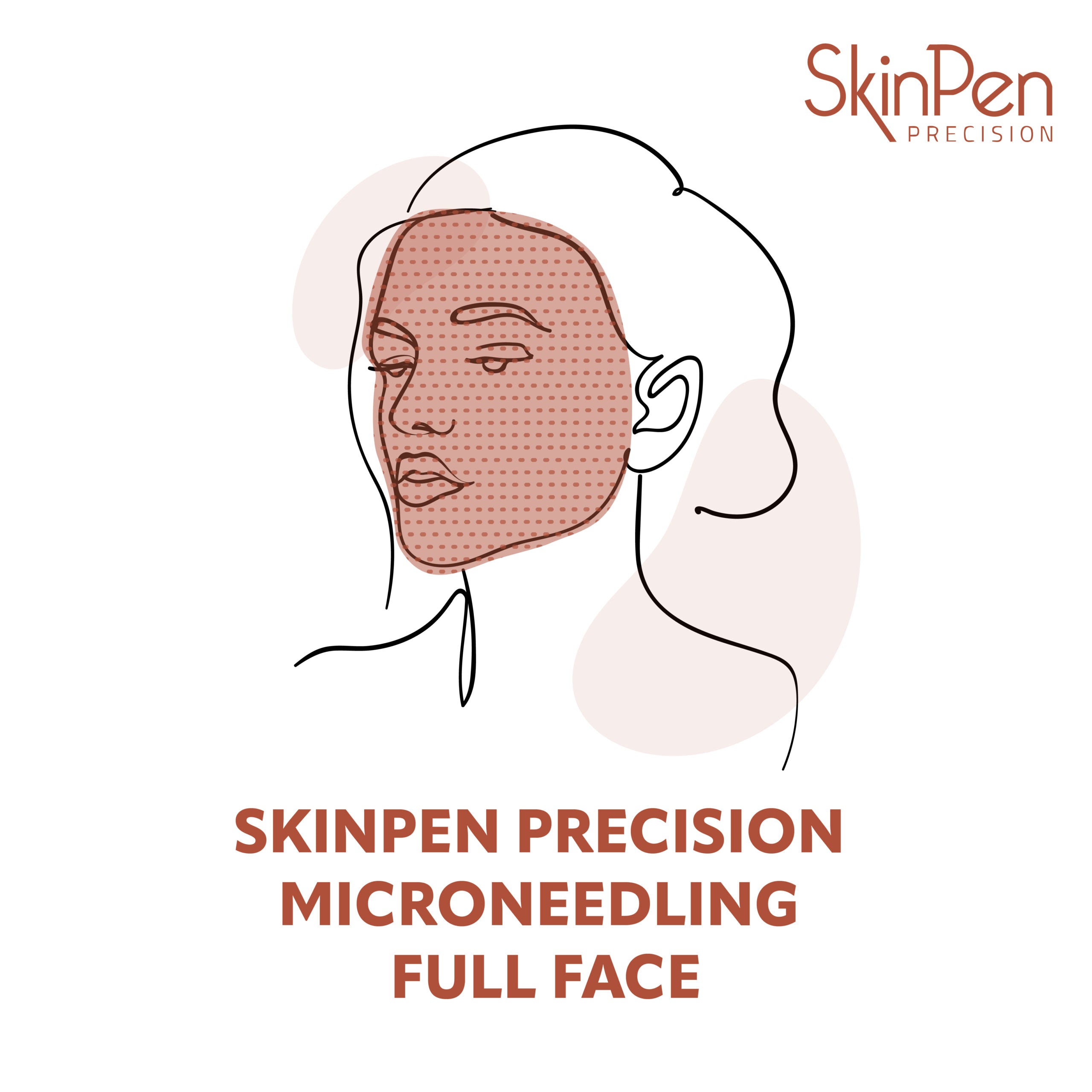Skinpen Full Face Precision Microneedling Treatments – Secret Skin