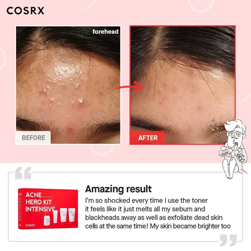 COSRX Acne Hero Kit Intensive 4-step Kit | Buy Online